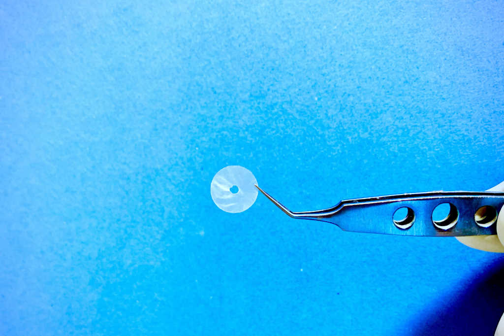 AmnioTek expands range in NZ - eyeonoptics