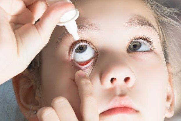 Dry eye prevalent in healthy children - eyeonoptics